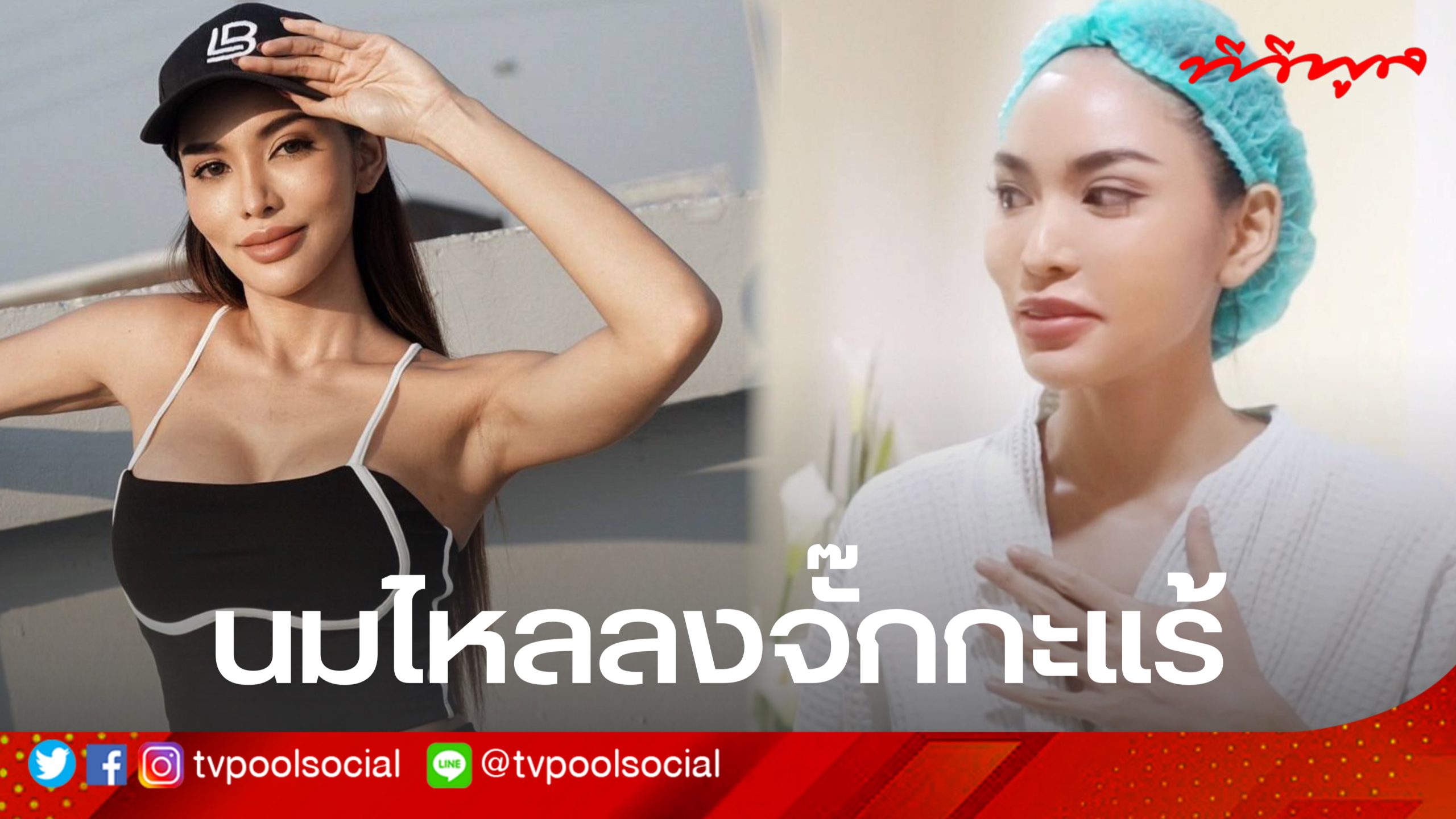 ศัลยกรรมทำพิษ แพรววา AF8 ทุกข์ทรมานใจ10ปี นมไหลลงจั๊กกะแร้ จนขาดความมั่นใจ